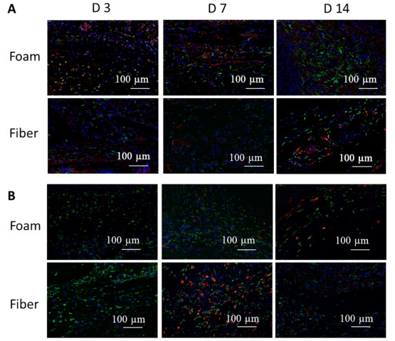 PGA Biofelt植入级无纺布聚乙醇酸 (PGA) 是一种可快速生物降解的聚合物，可用于各种植入物_支架_研究_荧光
