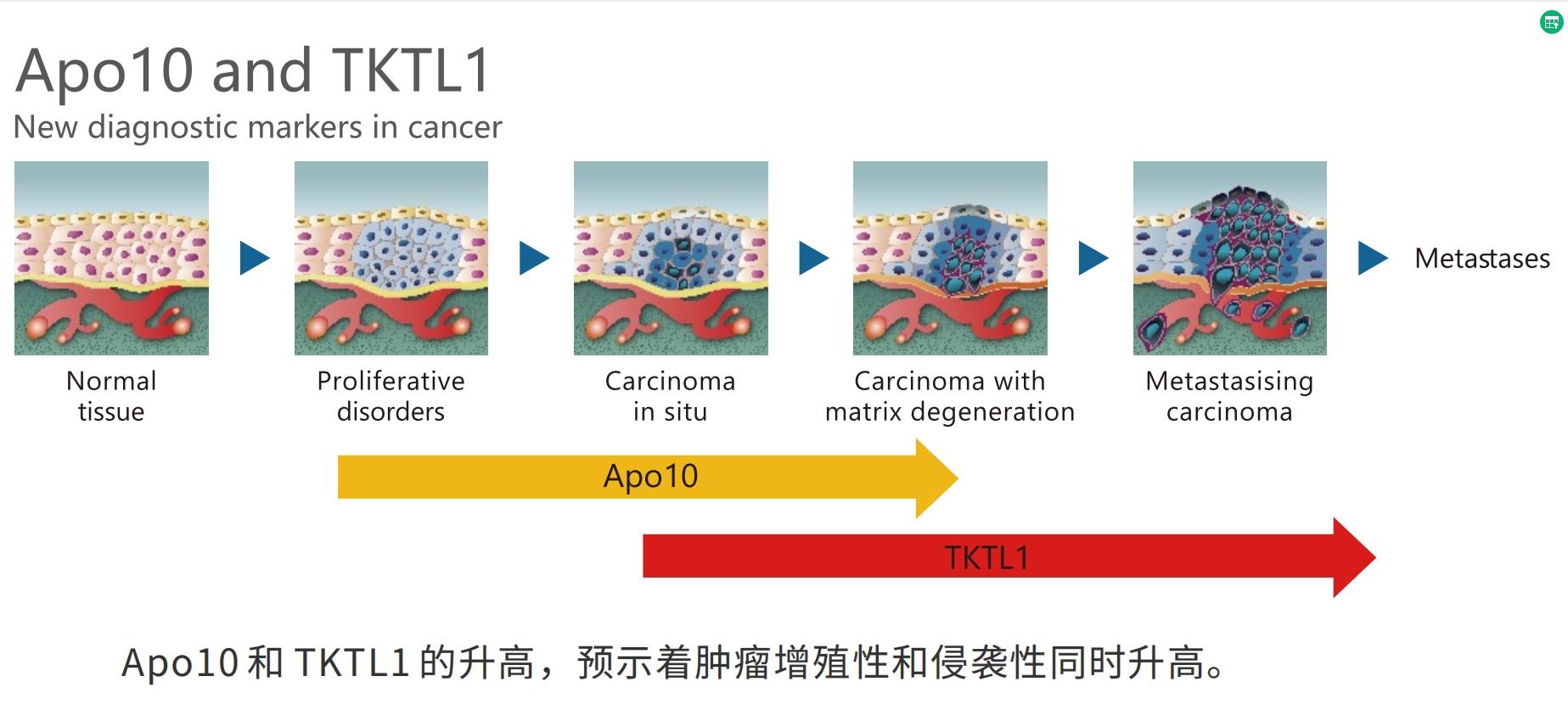 潘多姆检测报告中的两个标志物Apo10和TKTL1究竟代表什么含义？_研究_治疗_癌症