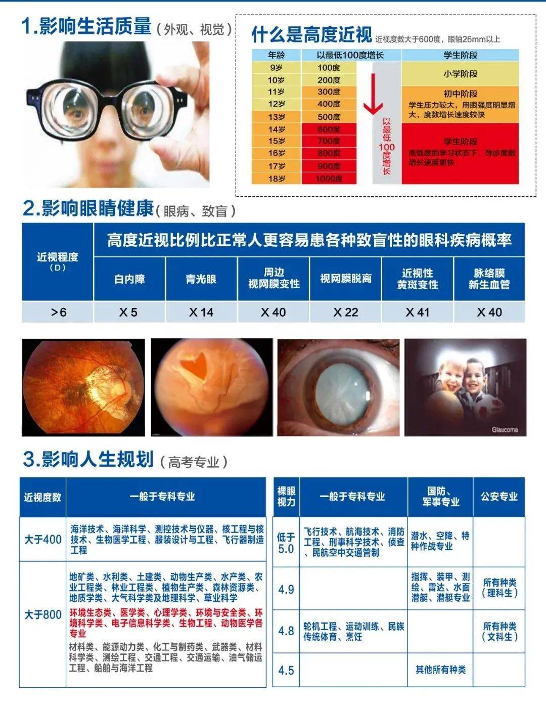 近视超过600度，这些运动不要做！手术患者度数eoi 8171