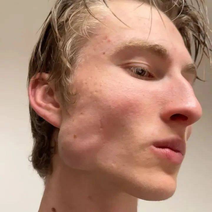 用切菜板锻炼咬肌，练出高级脸的他，全平台视频点击量如指数爆炸般突破几十亿次！_Andrew_面部_Maxxer