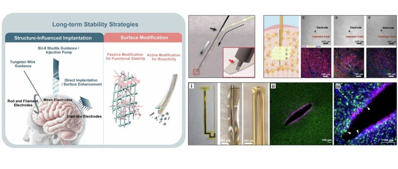综述：柔性深脑神经接口的长期稳定性策略_电极_炎症_形状